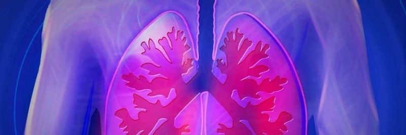 Bronchite Cronica: cause, rimedi e prevenzione